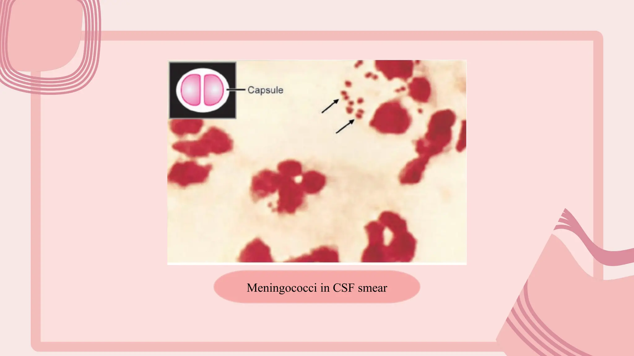 Neisseria Bacteria: Pathogenesis, Classification, and Clinical ...