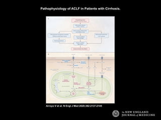 acute on chronic liver failure review article NEJM | PPTX