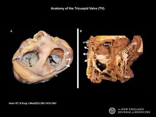nejmra2216709______________________.pptx
