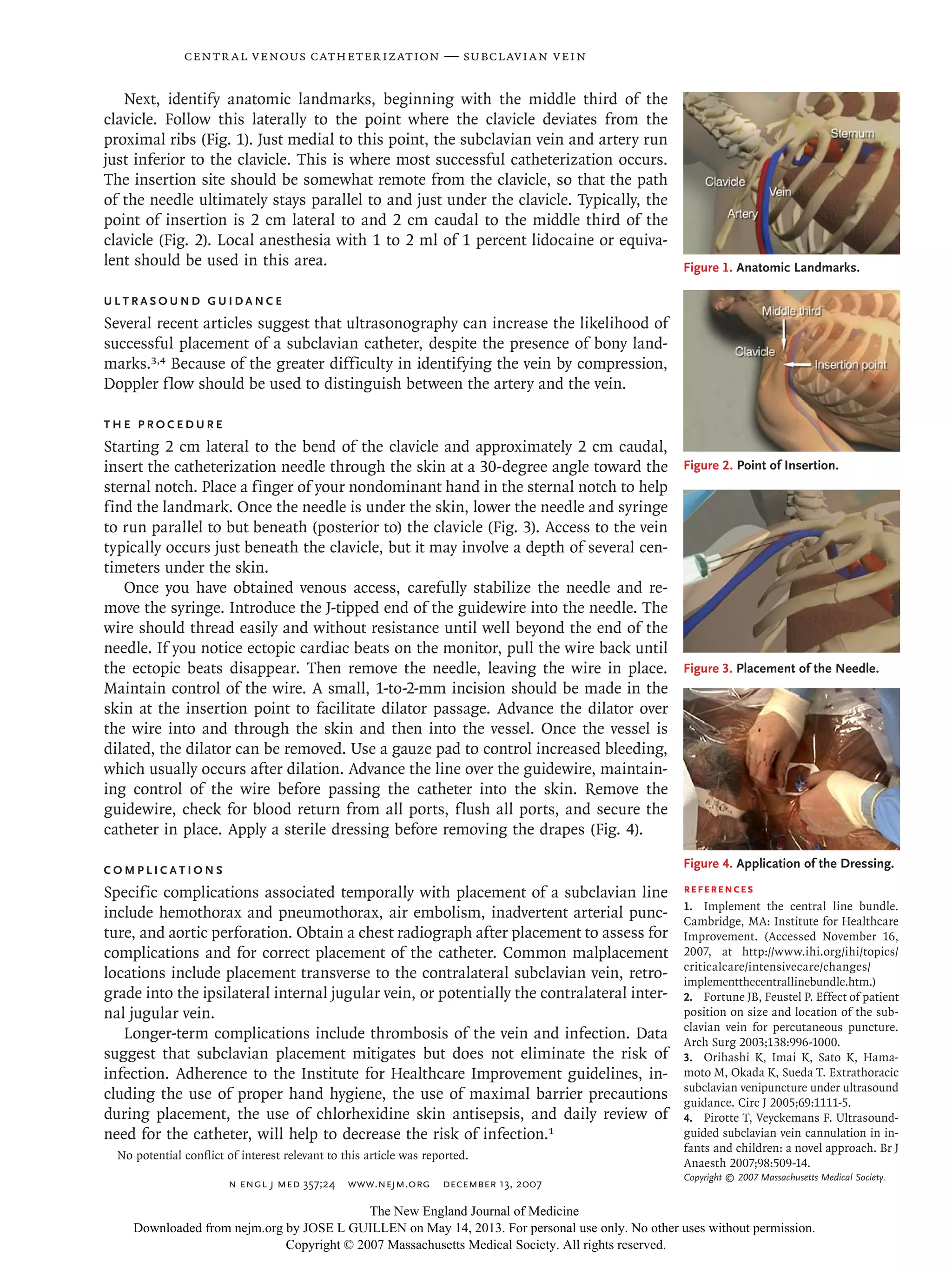 Nej mvcm074357 | PDF