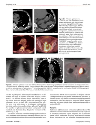 nelson-et-al-2024-spectrum-of-heterotopic-and-ectopic-splenic ...