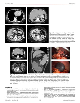 nelson-et-al-2024-spectrum-of-heterotopic-and-ectopic-splenic ...