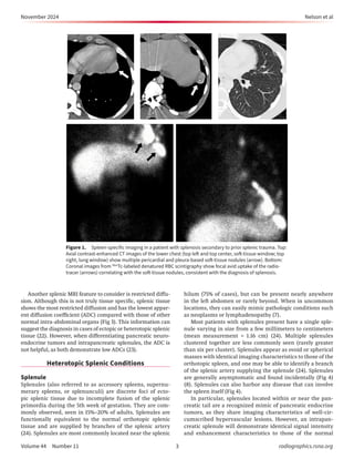 nelson-et-al-2024-spectrum-of-heterotopic-and-ectopic-splenic ...