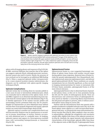 nelson-et-al-2024-spectrum-of-heterotopic-and-ectopic-splenic ...