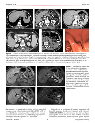 nelson-et-al-2024-spectrum-of-heterotopic-and-ectopic-splenic ...