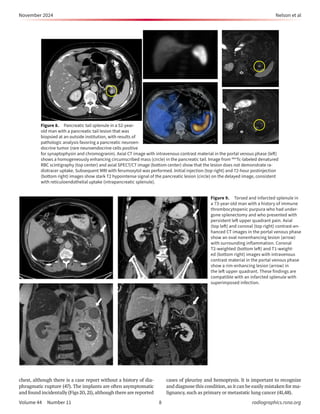 nelson-et-al-2024-spectrum-of-heterotopic-and-ectopic-splenic ...