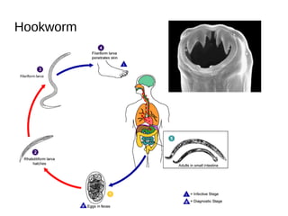 Phylum Nematoda Hookworm