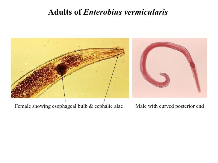 Nematoda Ascarids