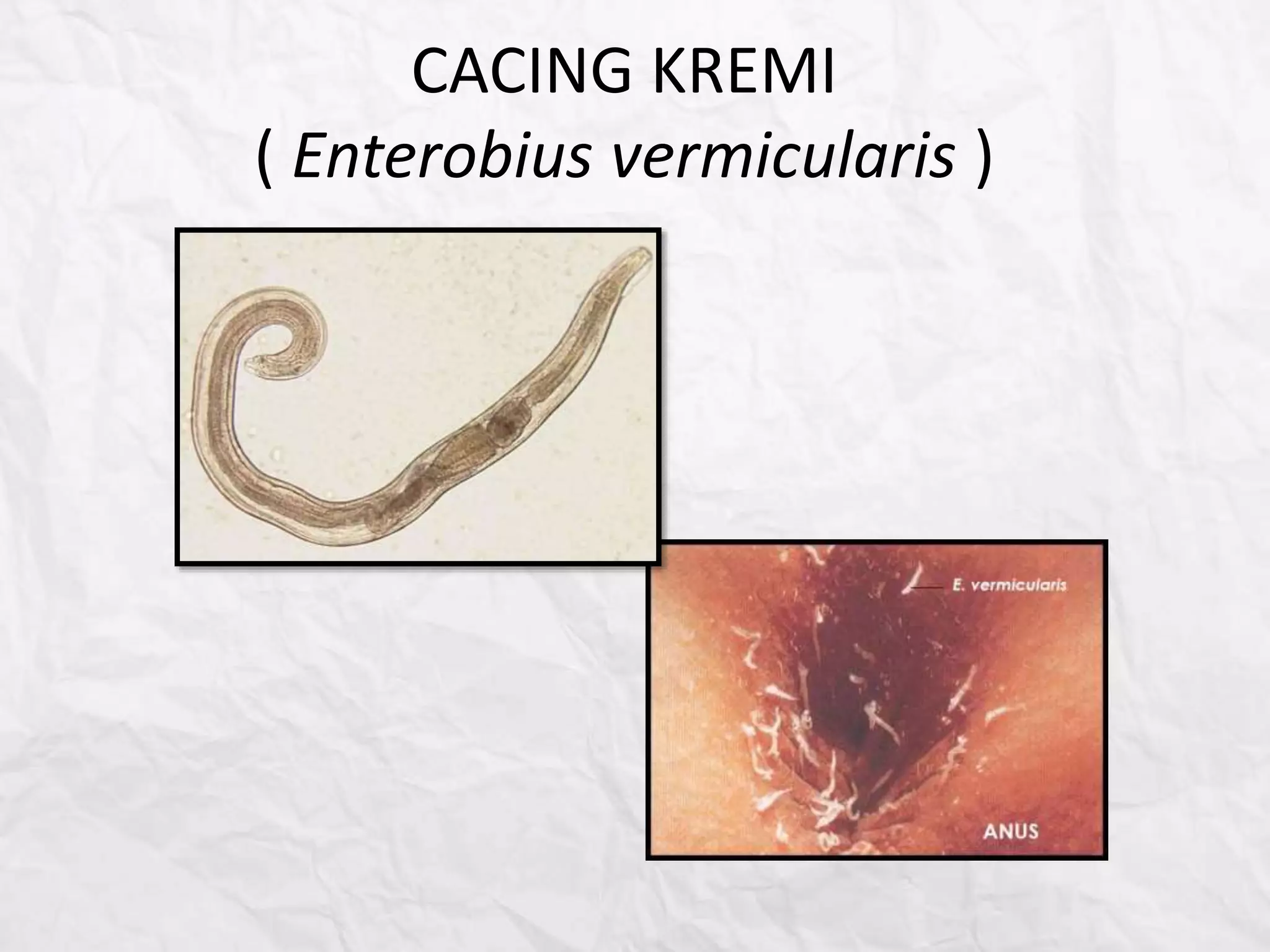 Nematoda dan annelida | PPTX