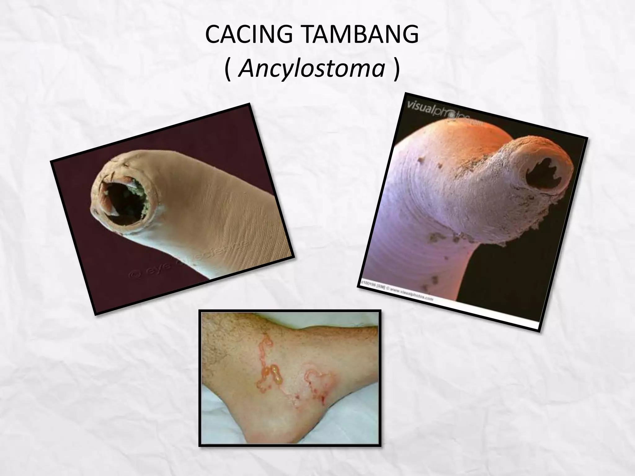 Nematoda dan annelida | PPTX