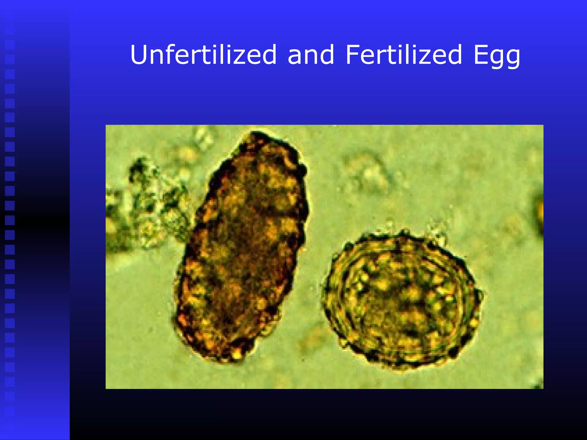 Nematode Ppt