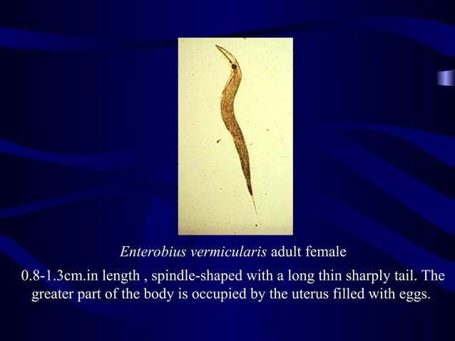 Nematodes, nematoda, round worms helminthology.ppt