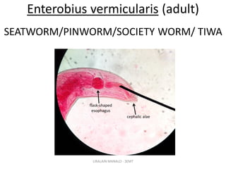 Identifying Different Nematodes and their Diagnostic forms | PPT