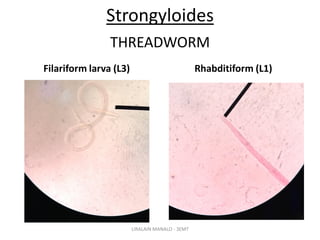 Identifying Different Nematodes and their Diagnostic forms | PPT