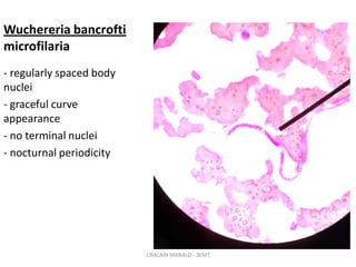 Identifying Different Nematodes and their Diagnostic forms | PPT