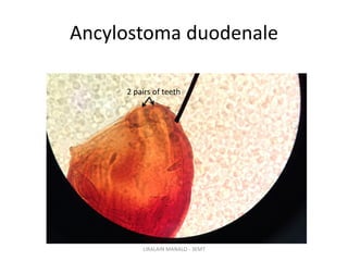 Identifying Different Nematodes and their Diagnostic forms | PPT