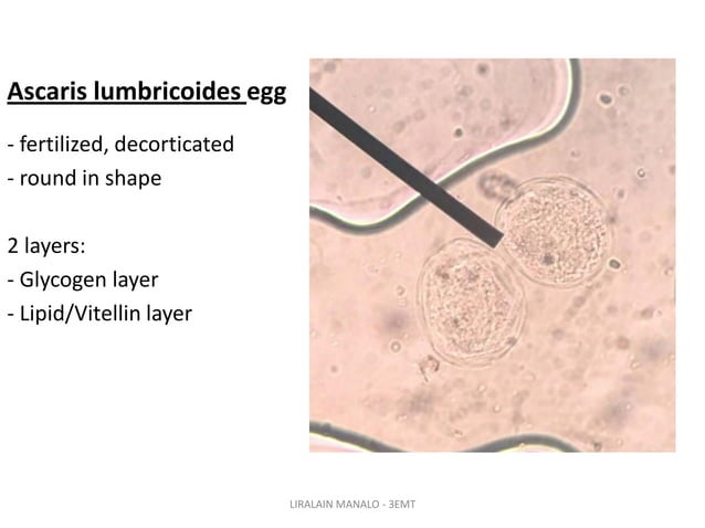 Identifying Different Nematodes and their Diagnostic forms | PPT