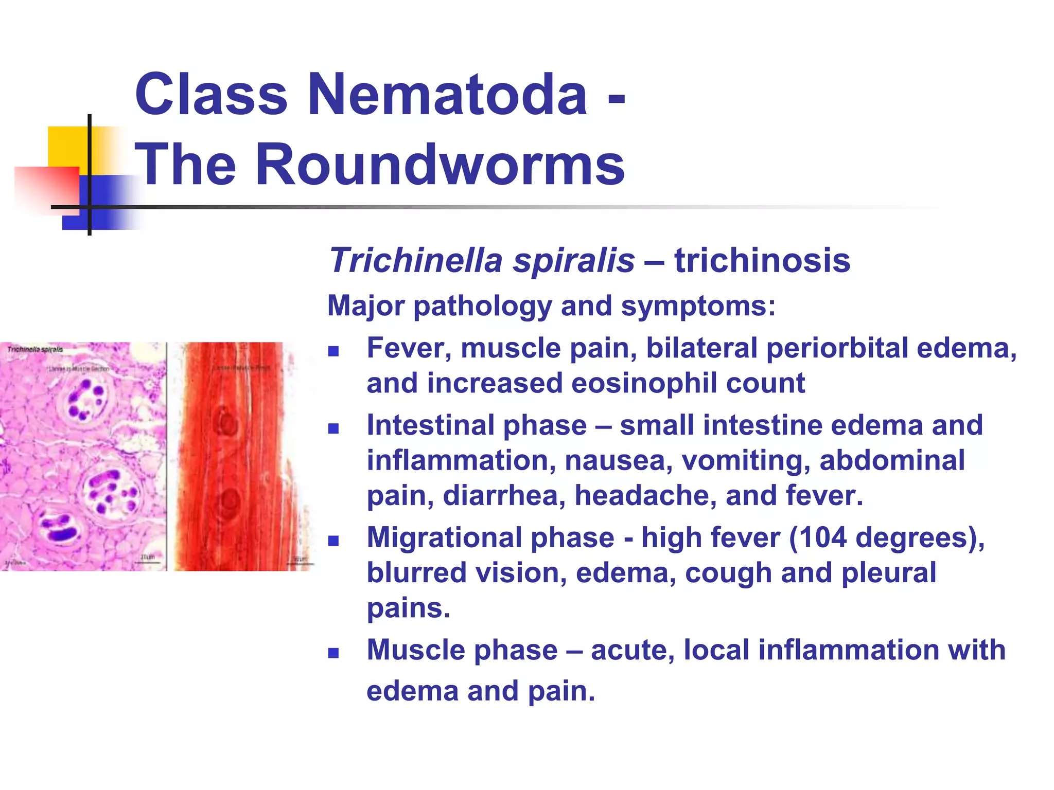 nematodes.pptx | Infectious Diseases | Diseases and Conditions