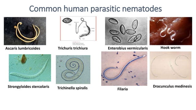 NEMATODES and Strogyloides.pptx