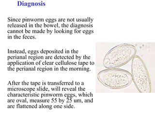 Nematodoses10 | PPT