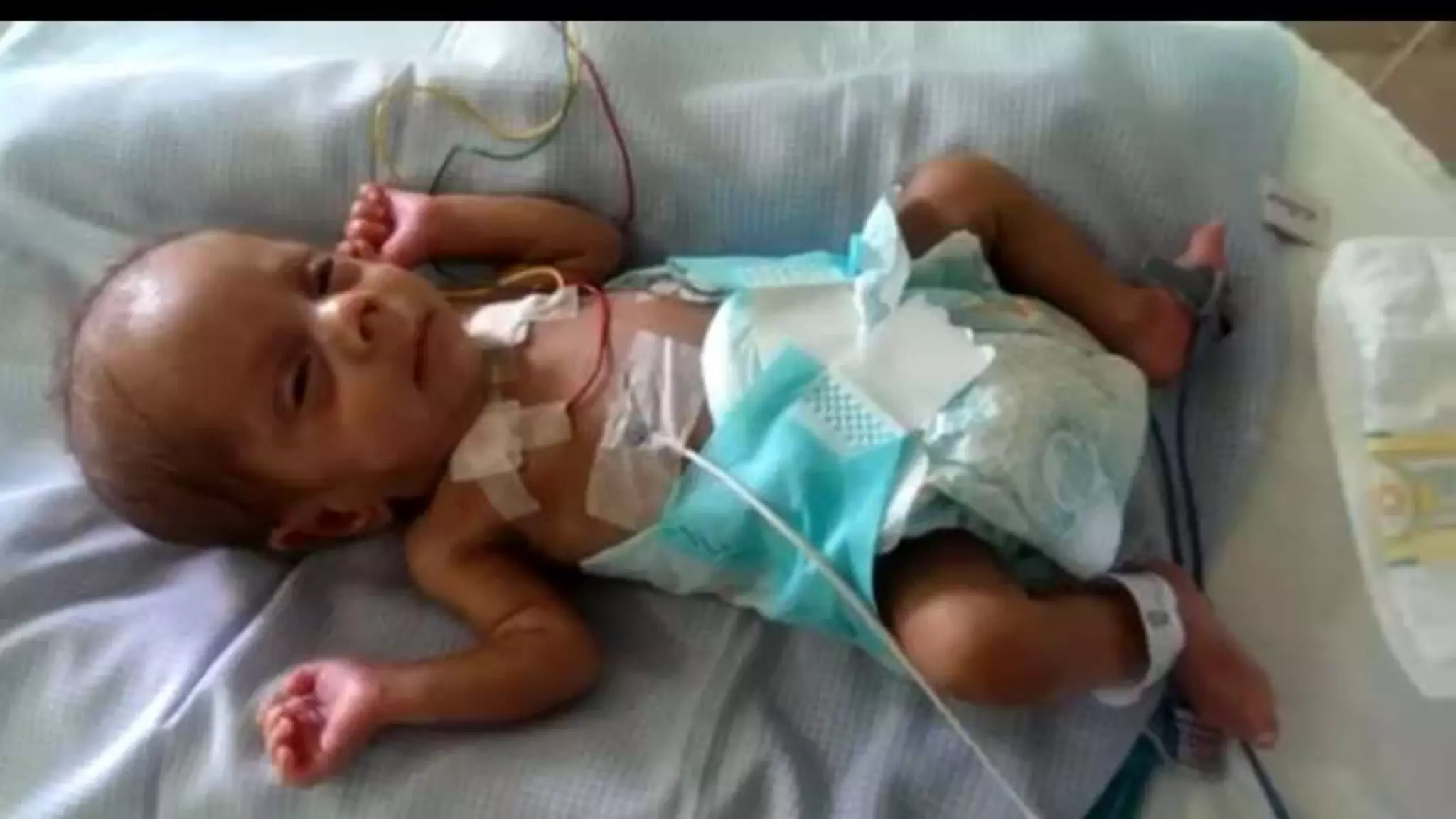 neonatal environment | PPTX
