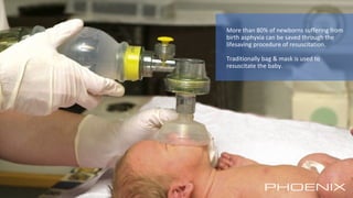 Neobreathe ( world’s first foot operated resuscitation care ) | PPT