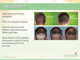 Neograft hair transplant by Beautologie | PPT