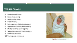Neonatal hypothermia - Competency based final MBBS | PPTX