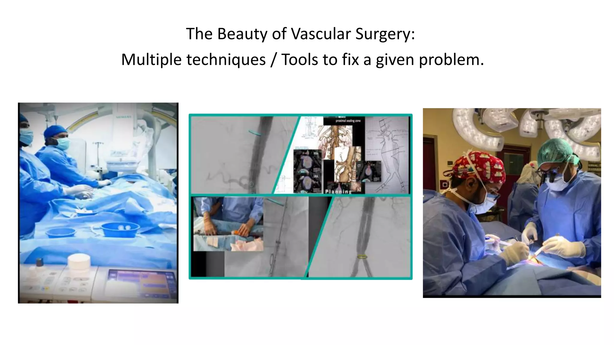 Neo innovation in Limb Ischemia Management | PPSX