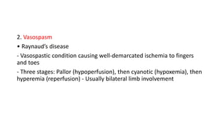 Neo innovation in Limb Ischemia Management | PPSX