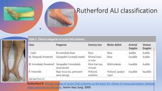 Neo innovation in Limb Ischemia Management | PPSX