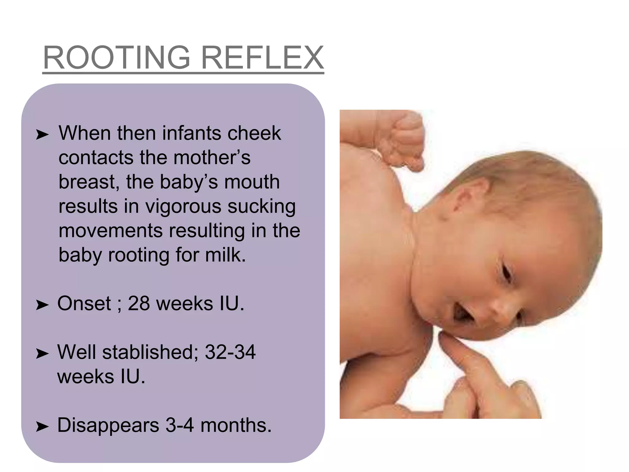 NEONATAL REFLEXES | PPTX