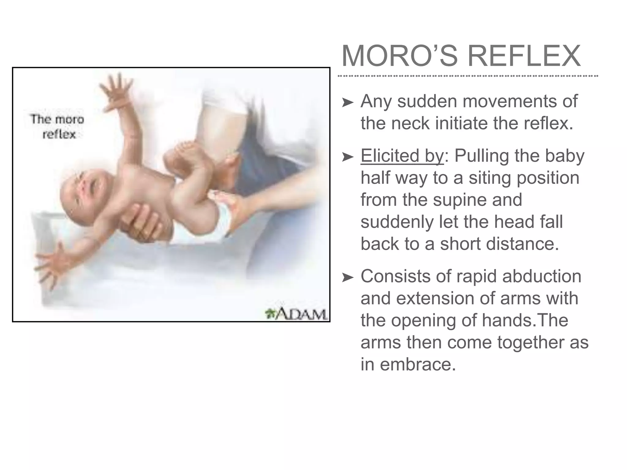 NEONATAL REFLEXES | PPTX