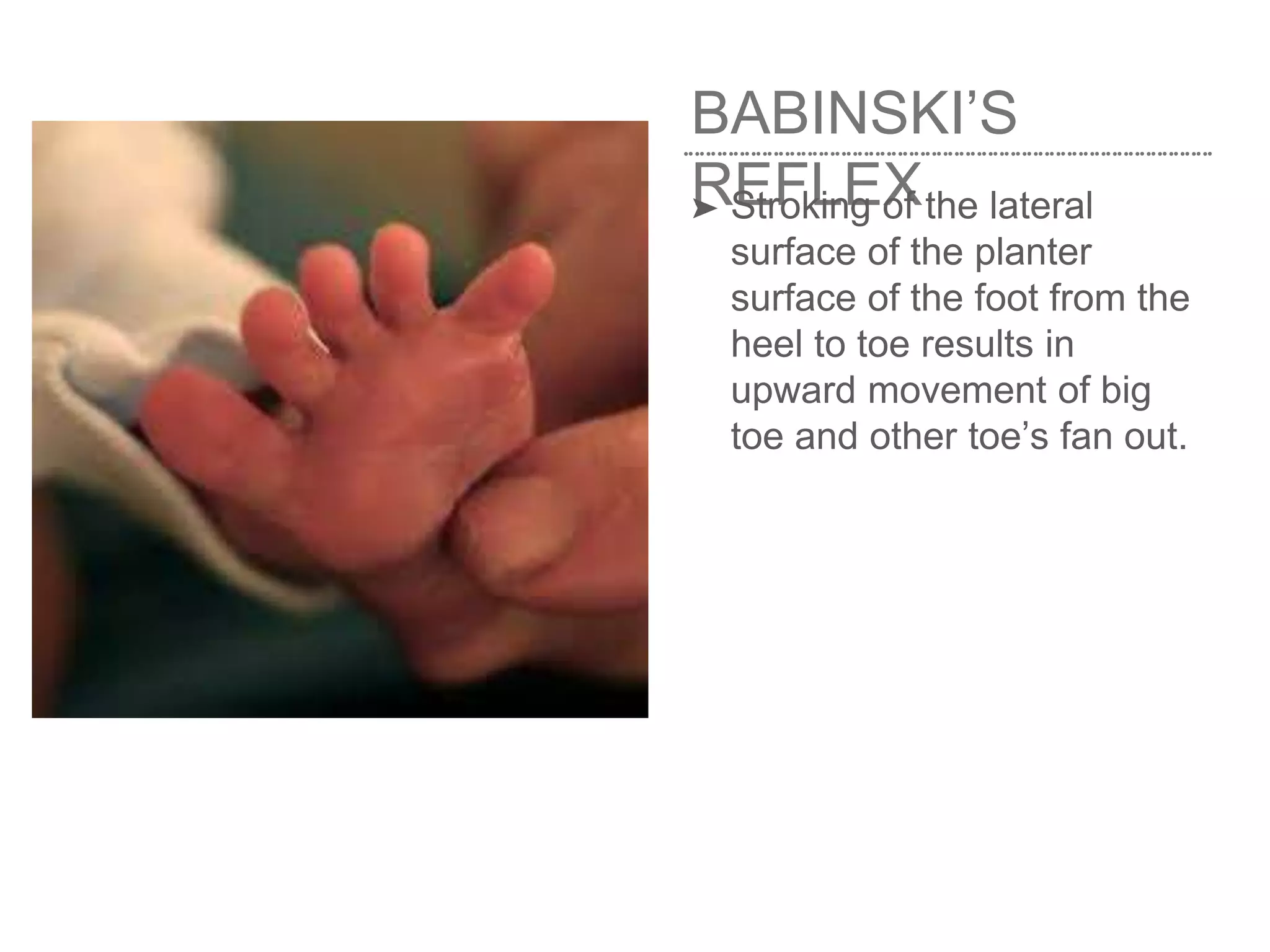 NEONATAL REFLEXES | PPTX