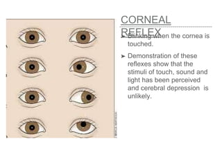NEONATAL REFLEXES | PPTX | Parenting Babies and Toddlers | Parenting
