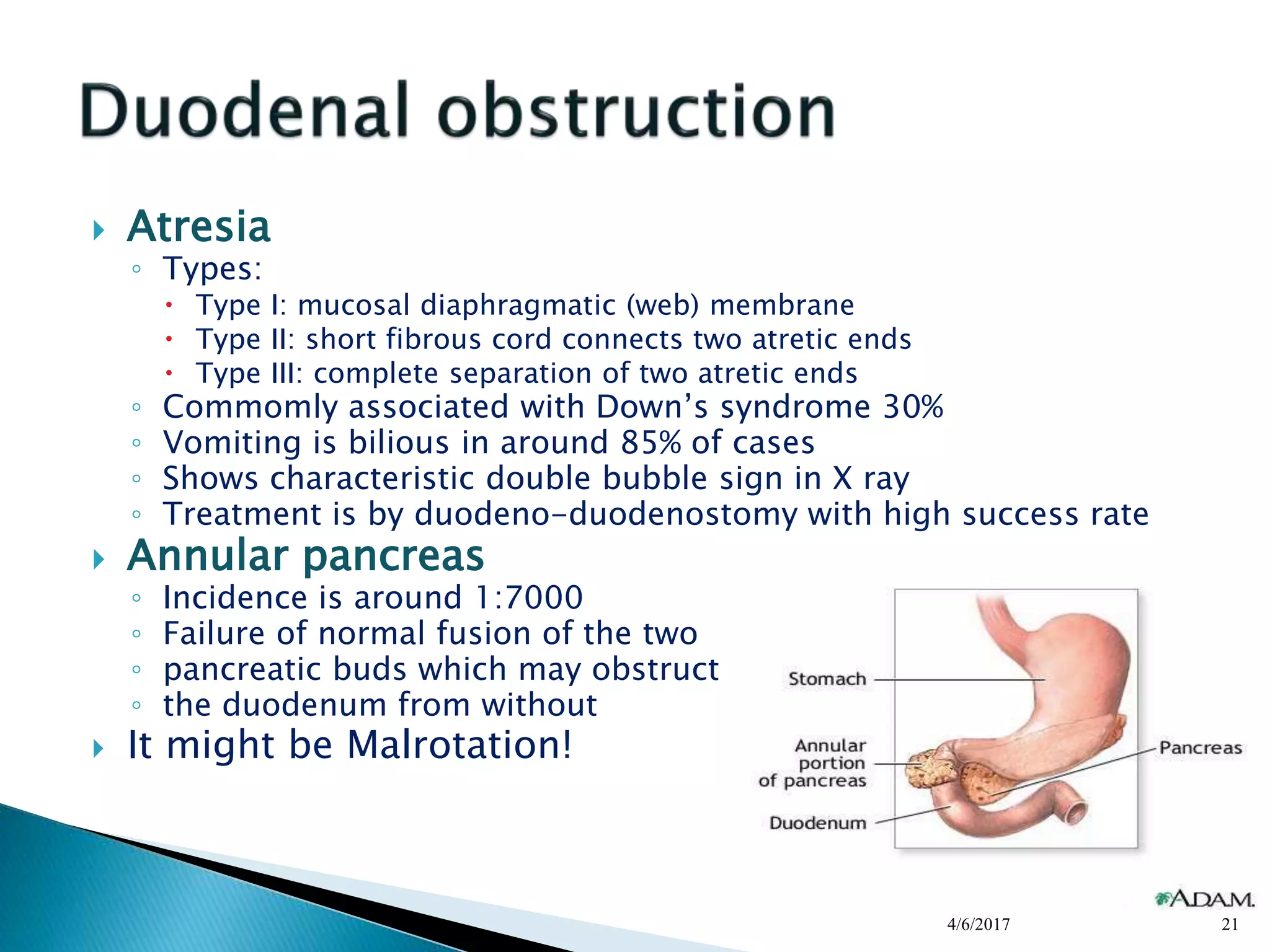 Neonatal intestinal obstruction | PPTX