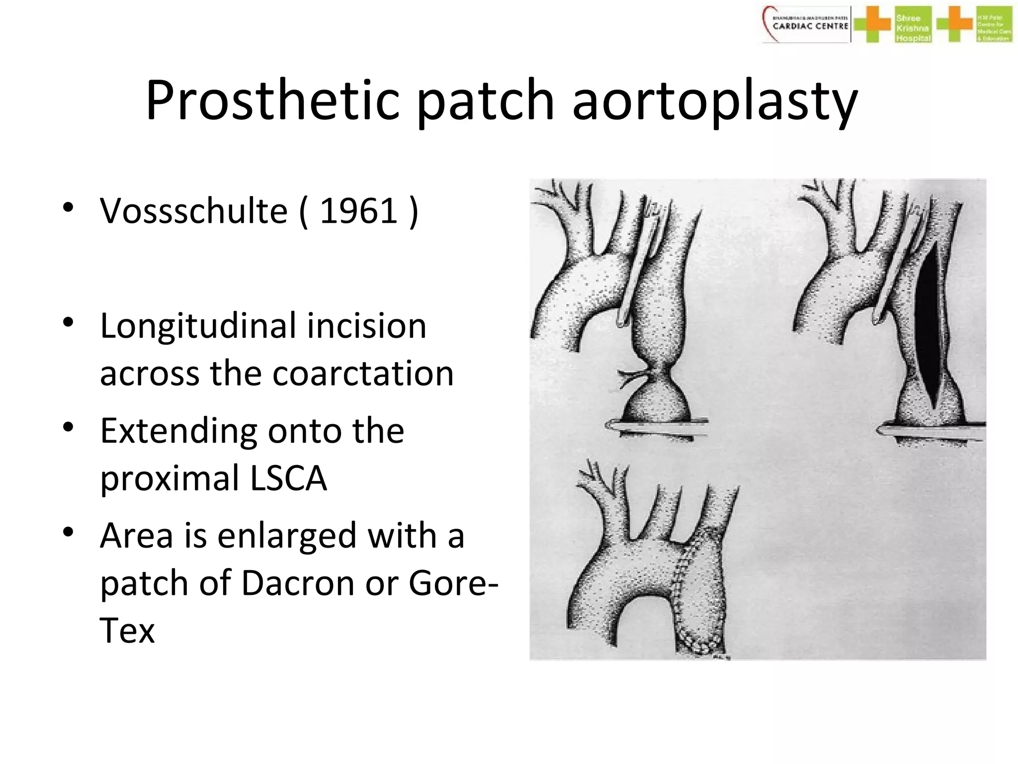 Neonatal coarc2 | PPT