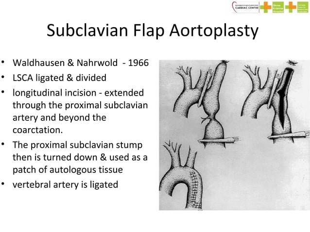 Neonatal coarc2 | PPT | Heart and Cardiovascular Diseases | Diseases ...