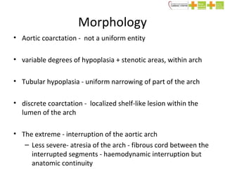 Neonatal coarc2 | PPT
