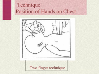 Neonatal resuscitation | PPT