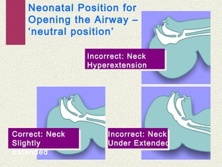 Neonatal resuscitation | PPT