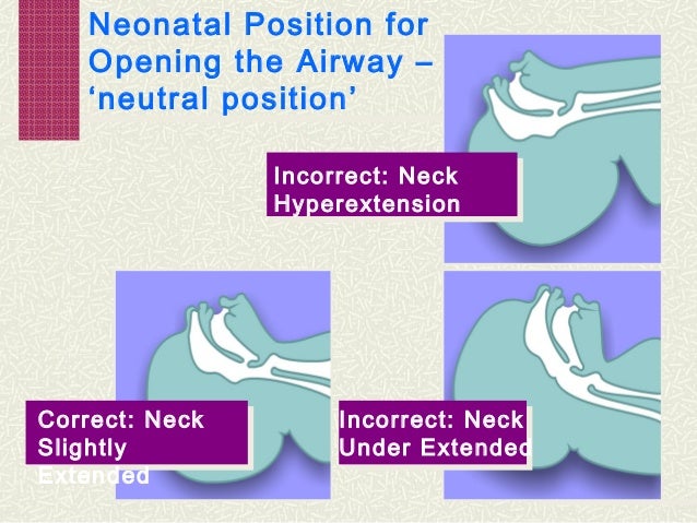 Neonatal resuscitation – DR. TRYNAADH