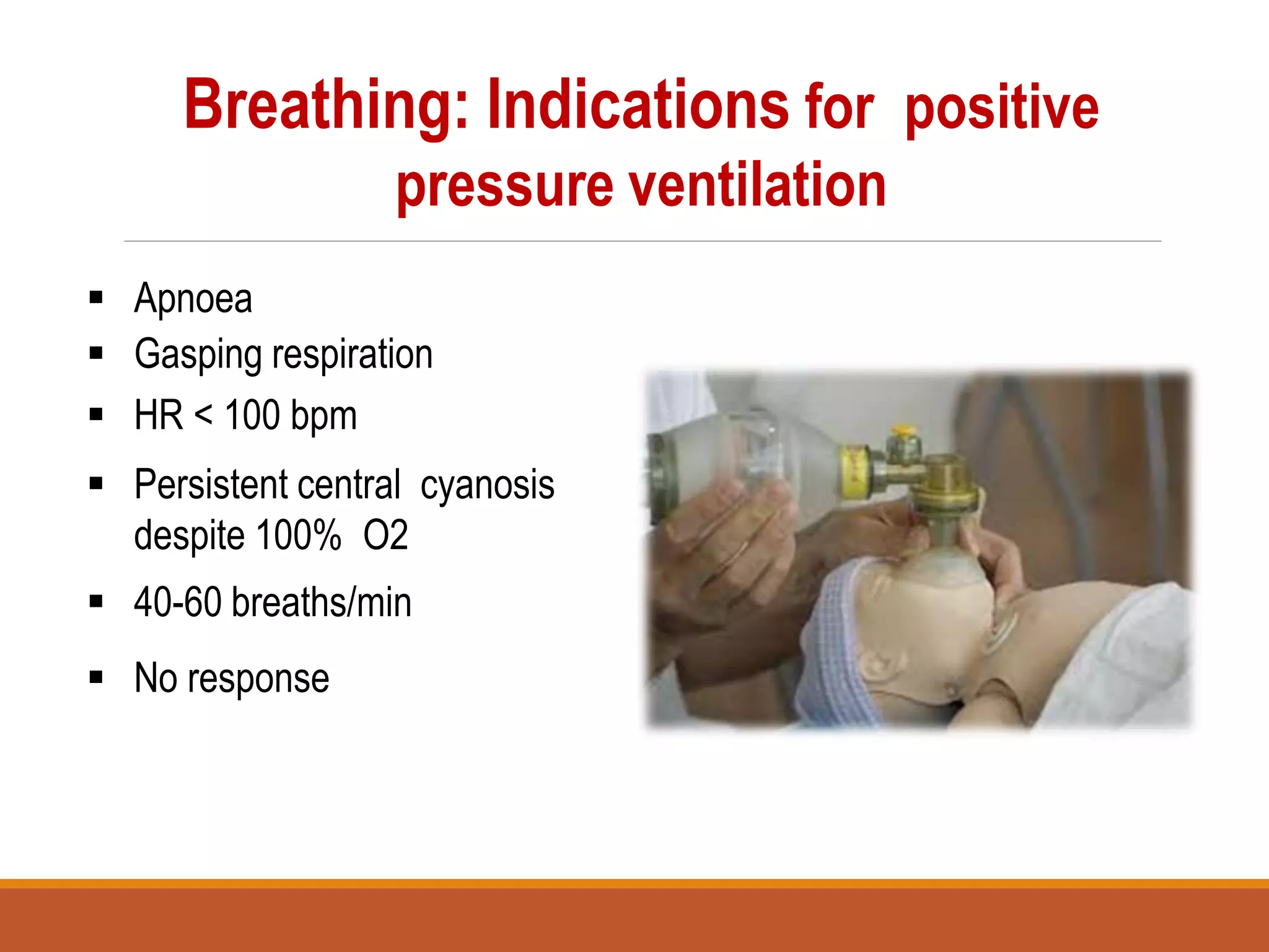 Neonatal resuscitation | PPT