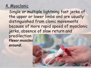 Neonatal-seizures.presentation-dr.priya.pptx