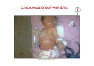 Neonatal-sepsis-converted.pptx