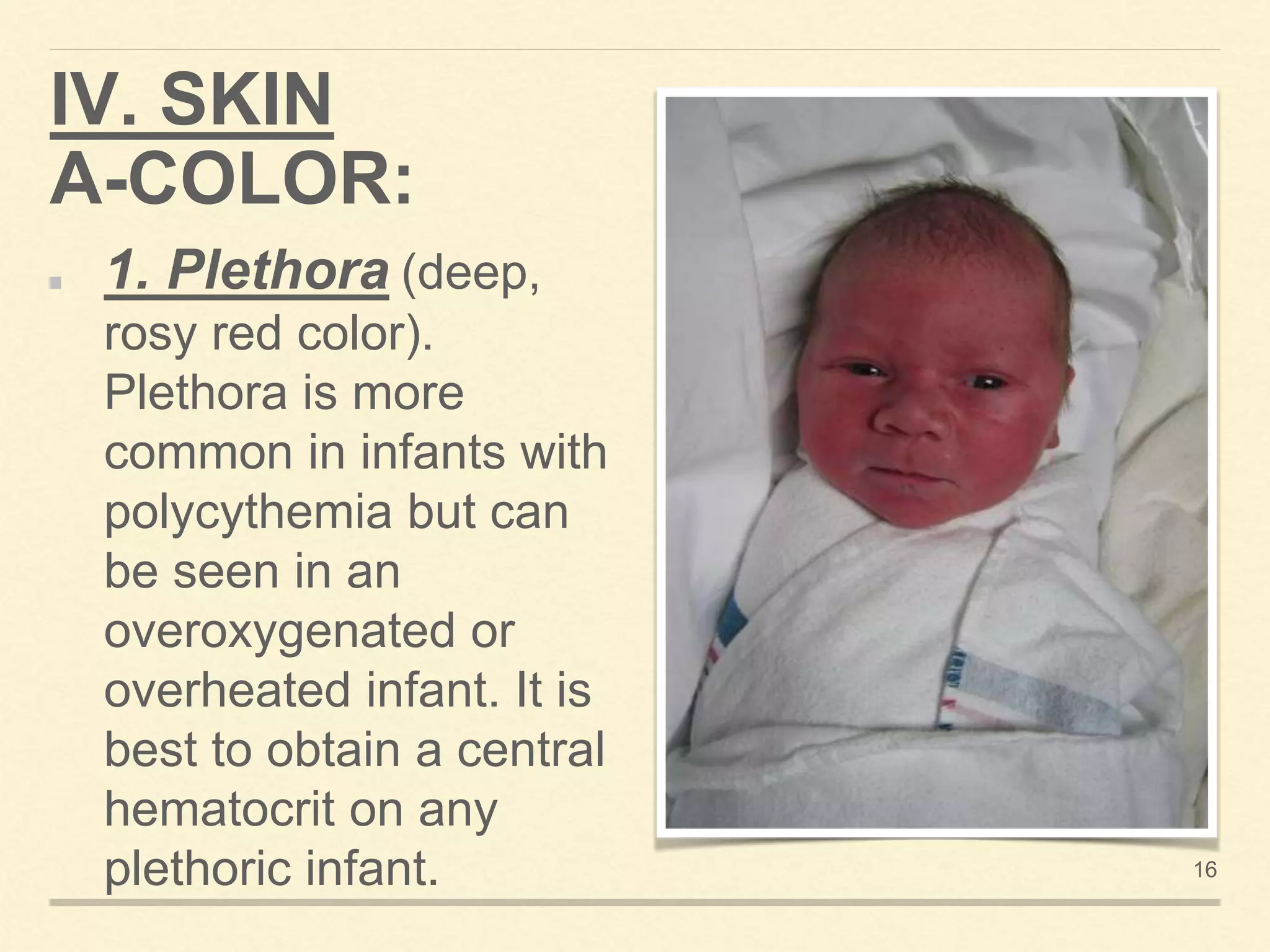 Neonatal examination | PPTX