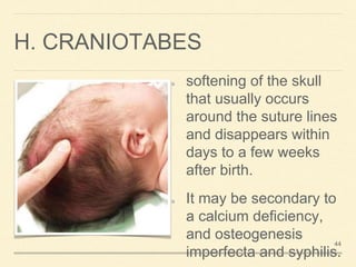 Neonatal examination | PPTX