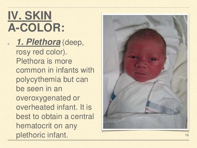 Neonatal examination