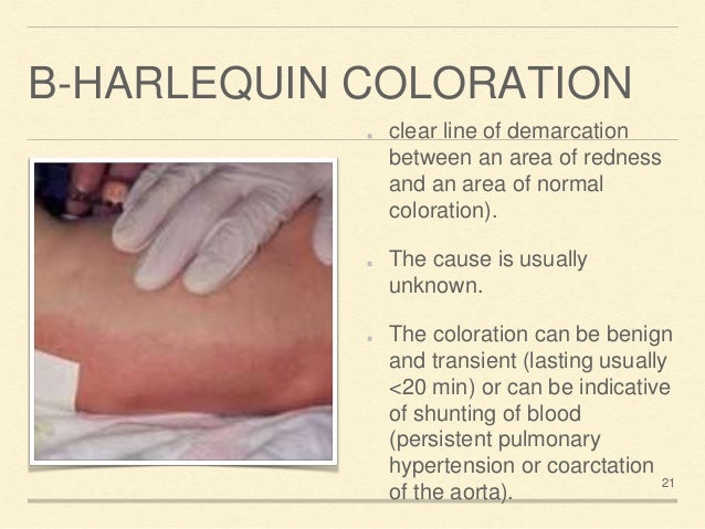 Neonatal examination