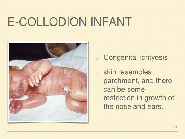 Neonatal examination